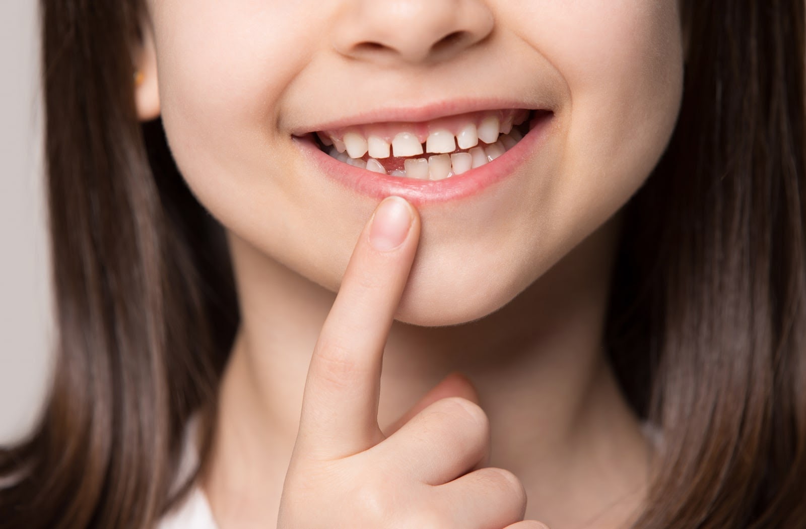 7 Children’s Teeth Problems Every parent Should Watch For